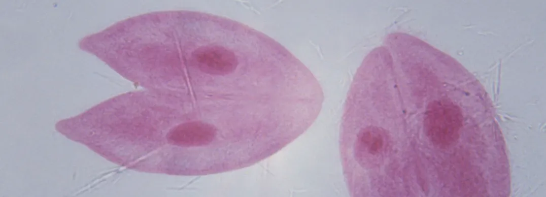 Protozoen-Infektionen: Diagnose und Therapieansätze